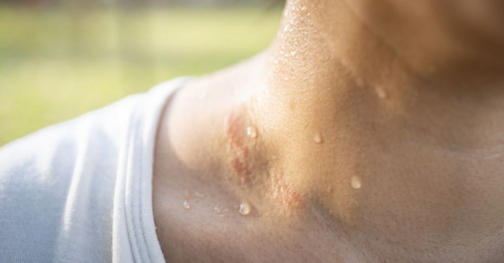Piqûre d'acarien : les erreurs à éviter à la maison quand on est allergique