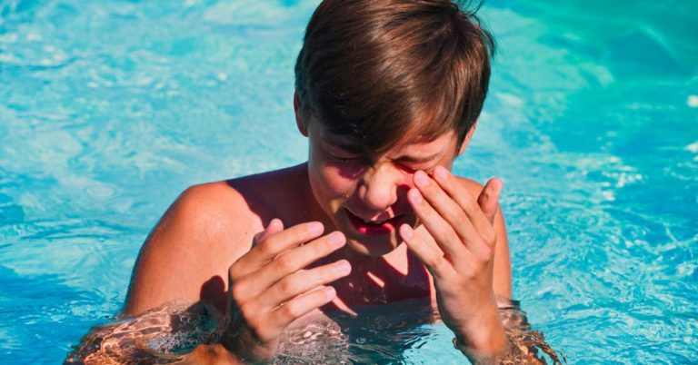 L'allergie au chlore : comment la reconnaître et la traiter